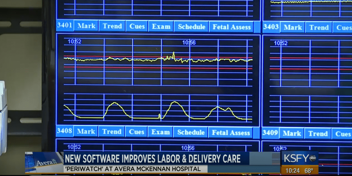 PeriGen improves standard of care for labor and delivery at Avera ...