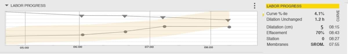 Early warning systems in obstetrics - PeriWatch Vigilance
