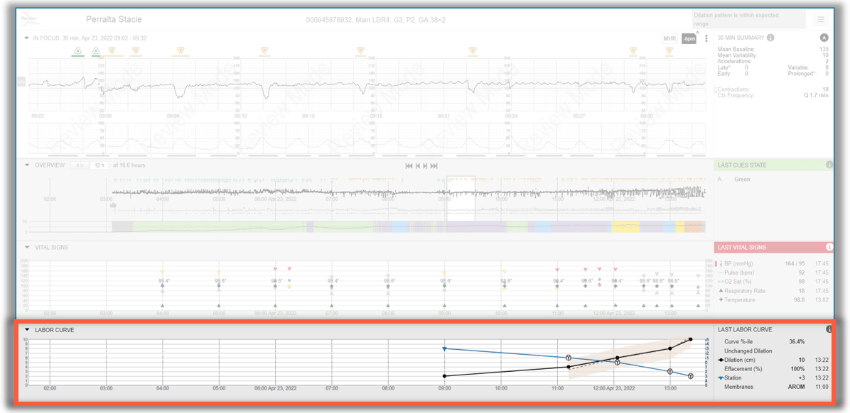 Expert Review by PeriGen Highlights Need for Advanced Labor Curve ...