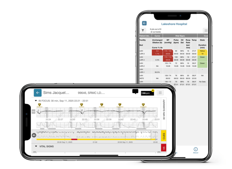 PeriWatch Vigilance Mobile Solution - PeriGen